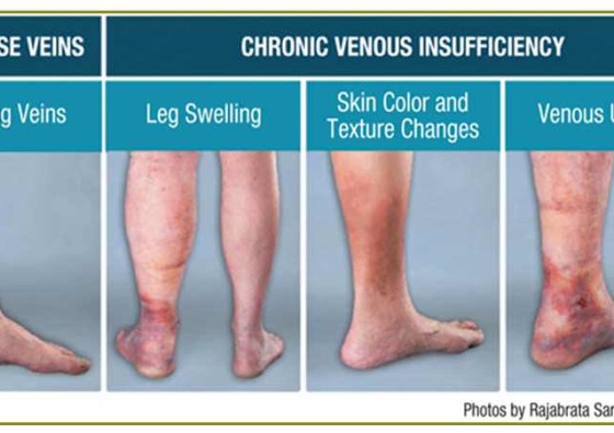 Preparati | Biljni preparati | Strana 4